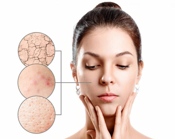 Sebaceous Cyst Pure Skin Clinic
